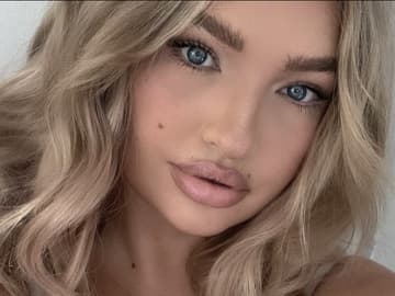 GNTM-Star Sarina Nowak hatte einen Hirntumor