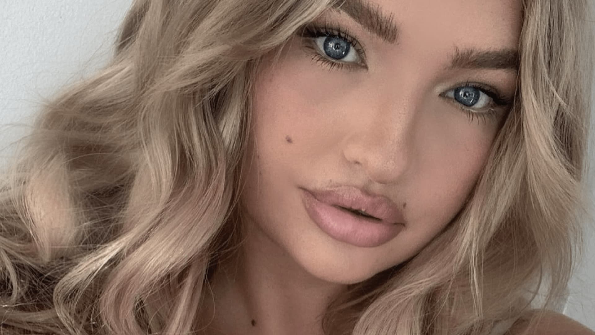 M-Star Sarina Nowak hatte einen Hirntumor