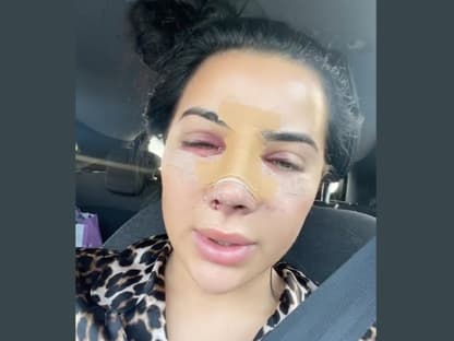 Leyla Lahouar: Früher & heute - So sah sie vor den Beauty-OPs aus