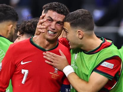 Cristiano Ronaldo: Botox & Beauty-OP? Experte hat Verdacht um sein Gesicht