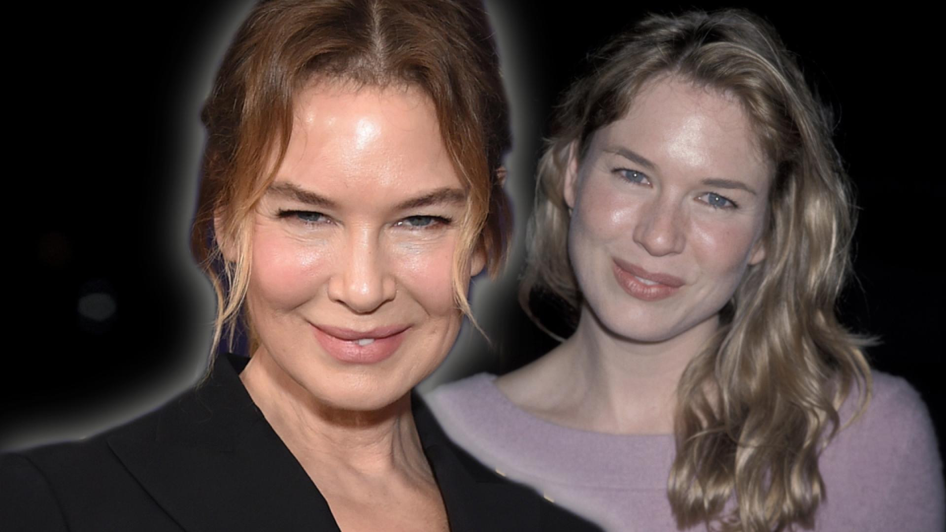 Renée Zellweger: Früher & heute - Ihre krasse Veränderung