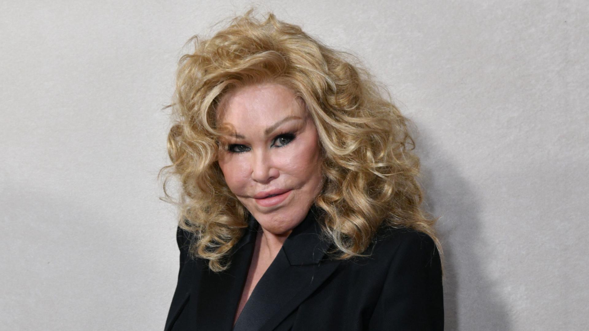 Jocelyn Wildenstein (†): So sah die "Katzenfrau" vor ihren Beauty-OPs aus