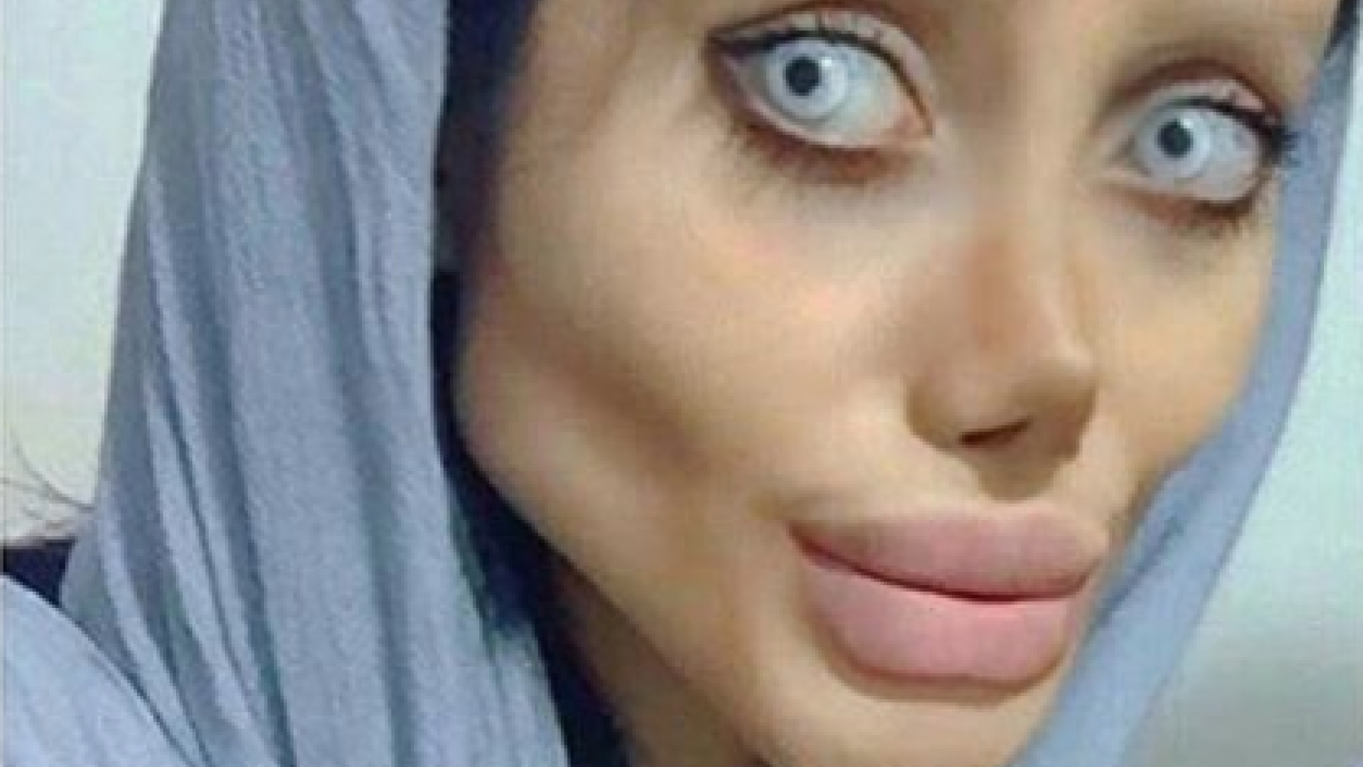 Sahar Tabar: Grusel-Schock! Über 50 Operationen um wie Angelina Jolie ...