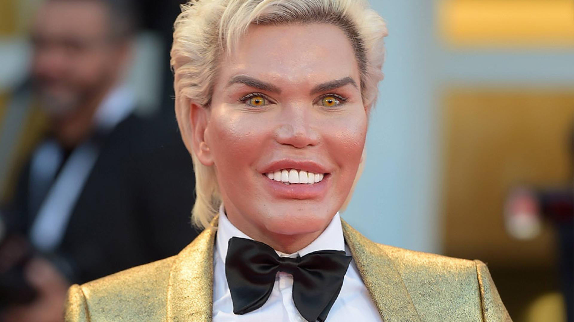 OP-Wahnsinn von Rodrigo Alves: Fällt der Real-Life-Ken bald auseinander?