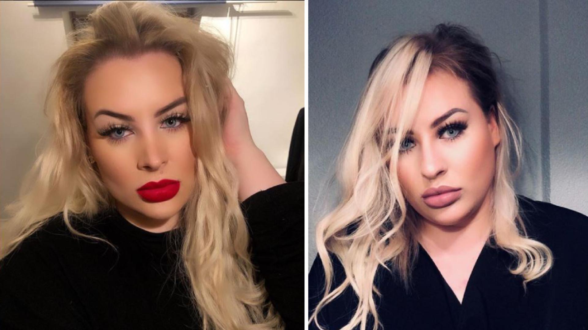 Ex-DSDS-Star Aline Bachmann: "SO habe ich 80 Kilo abgenommen!"