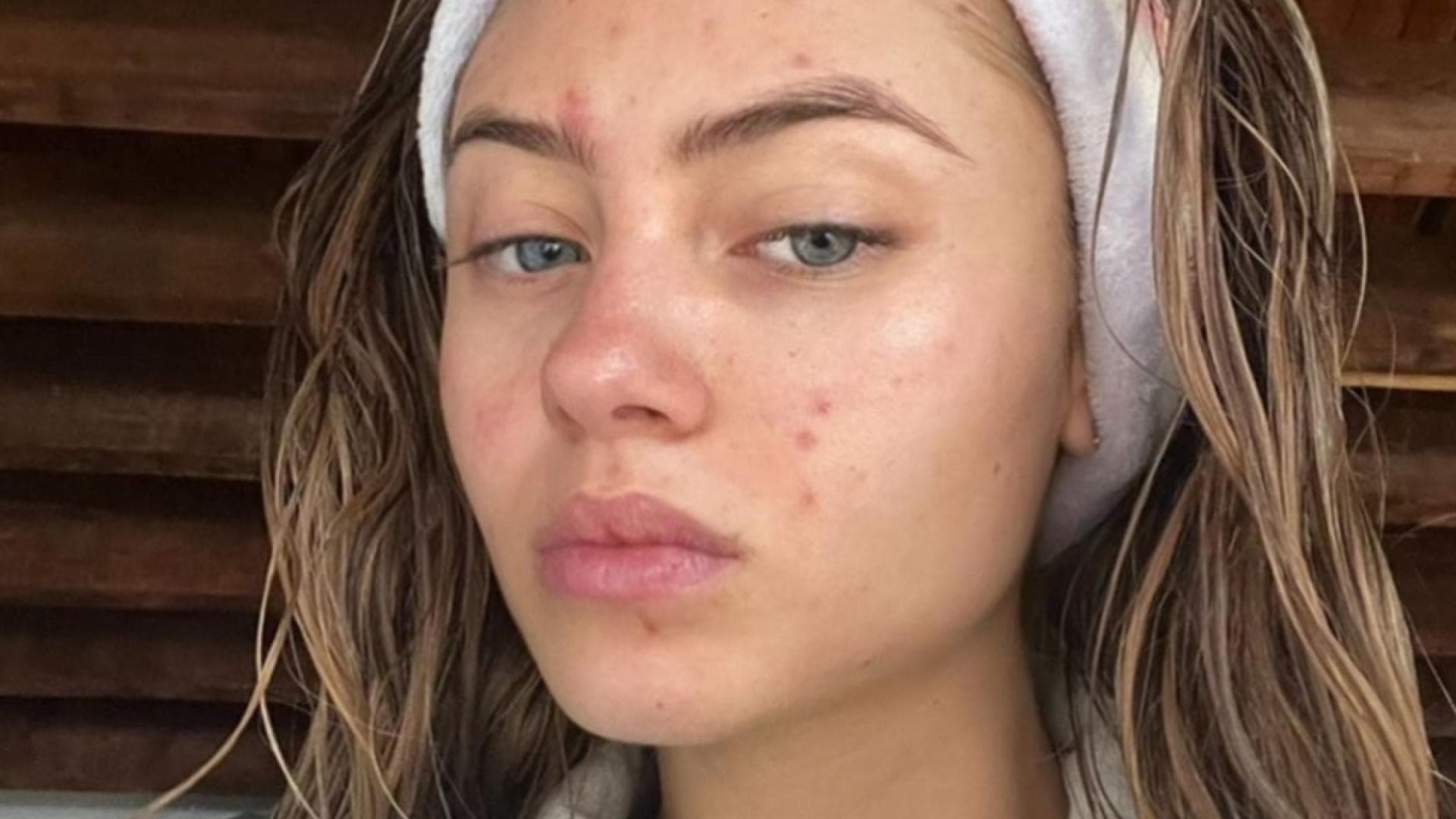 Leni Klum: Trotz Pickeln - Sie zeigt sich ungeschminkt im Netz