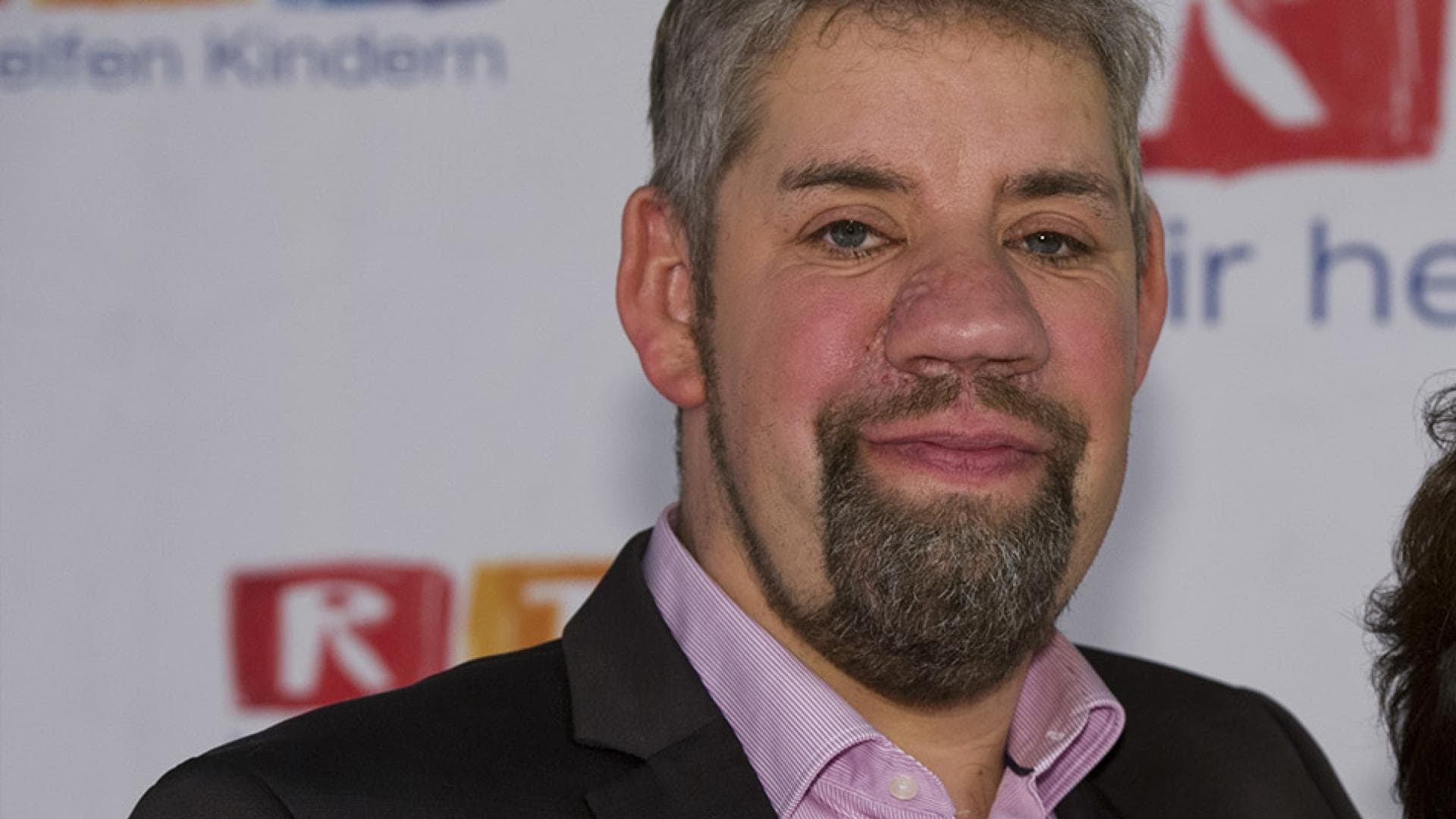 "Bauer sucht Frau"-Uwe Abel: Großer Schock nach Zahn-OP