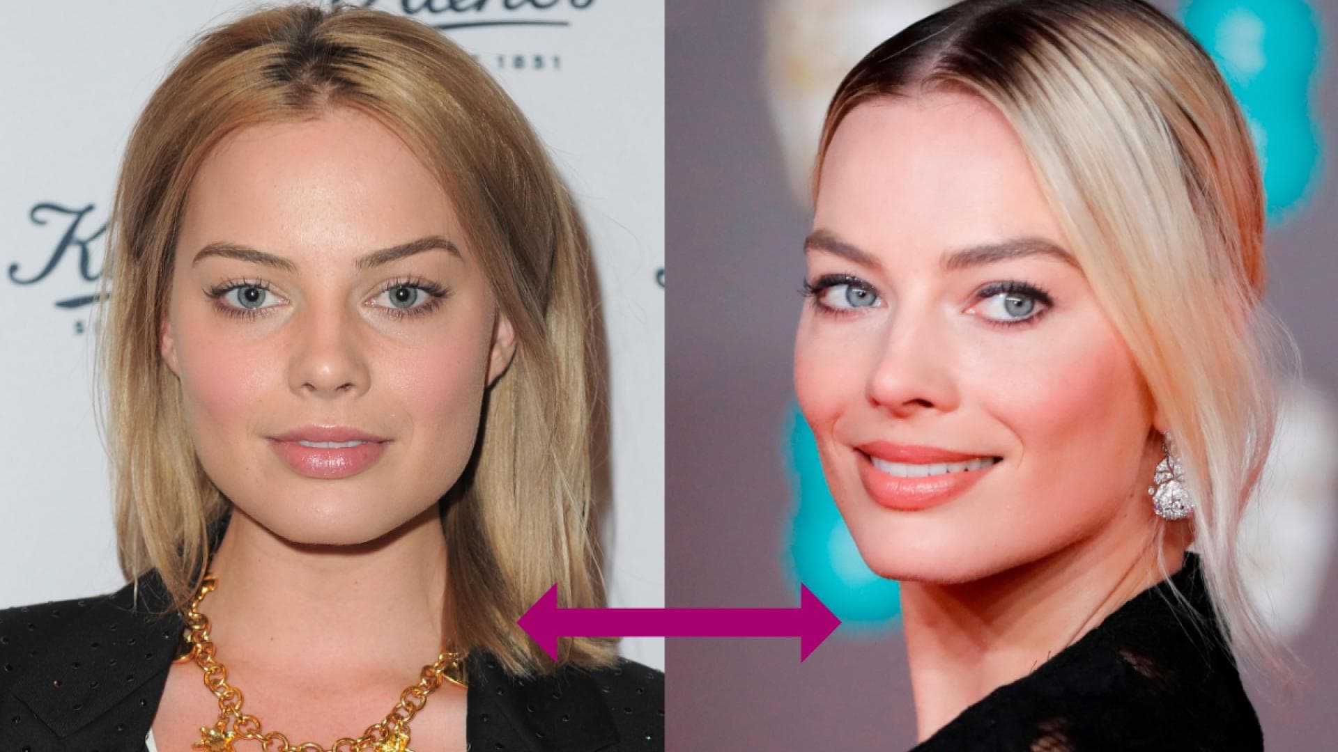 Beauty-Lexikon: Die besten Tricks bei einer breiten Nase