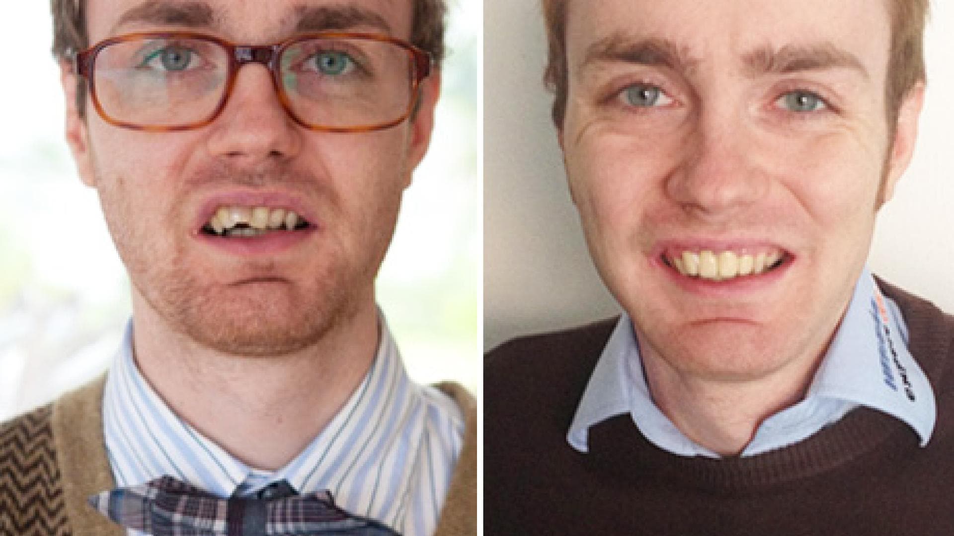 'Beauty and the Nerd'-Sieger Kevin lässt sich Zahn richten!