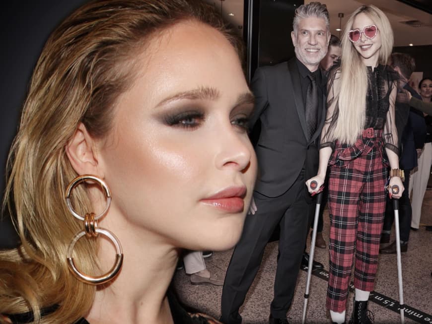 GNTM-Theresia Fischer: Dramatischer OP-Wahn für ihren Ex-Partner