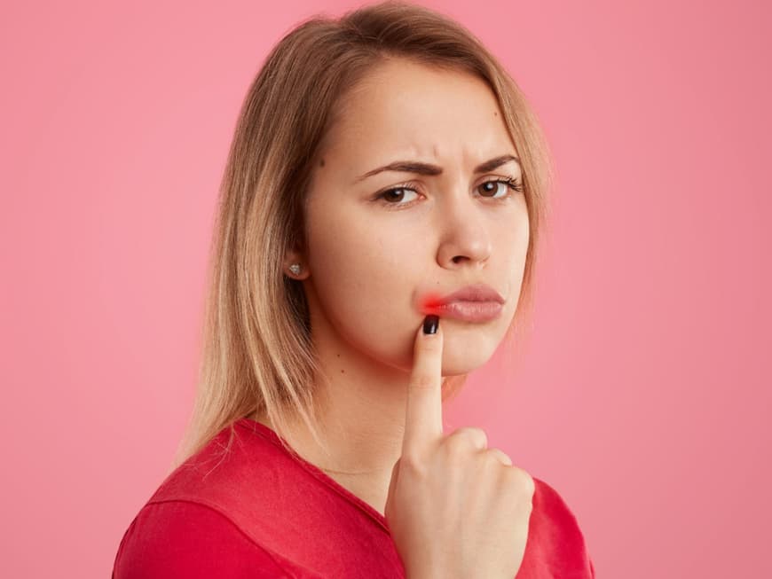 Herpes vorbeugen: So entstehen Lippenbläschen gar nicht erst