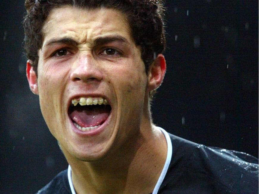 Cristiano Ronaldo: Botox & Beauty-OP? Experte hat Verdacht um sein Gesicht