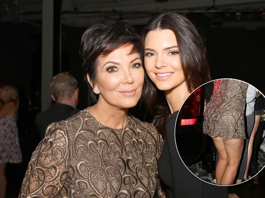 Cellulite-Alarm! Diese Stars haben eine Orangenhaut