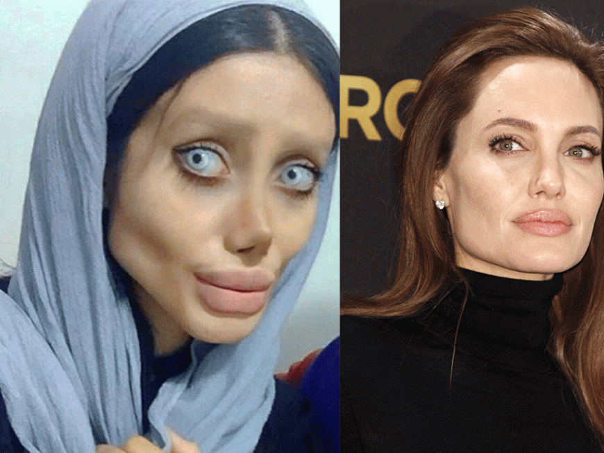 Sahar Tabar: Grusel-Schock! Über 50 Operationen um wie Angelina Jolie ...