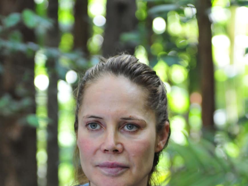 Dschungel-Star Doreen Dietel über ihre verpfuschten Lippen